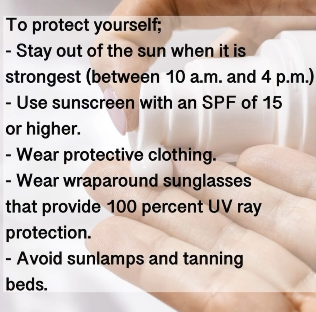 Protect Yourself From Sun Exposure | MyHealthfulDiet.Com